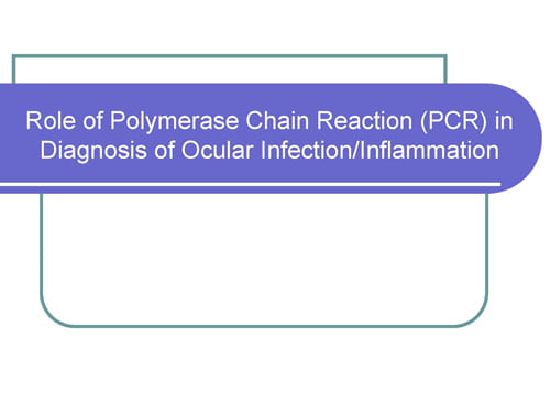 Role of Polymerase Chain Reaction (PCR) In Diagnosis of Ocular ...