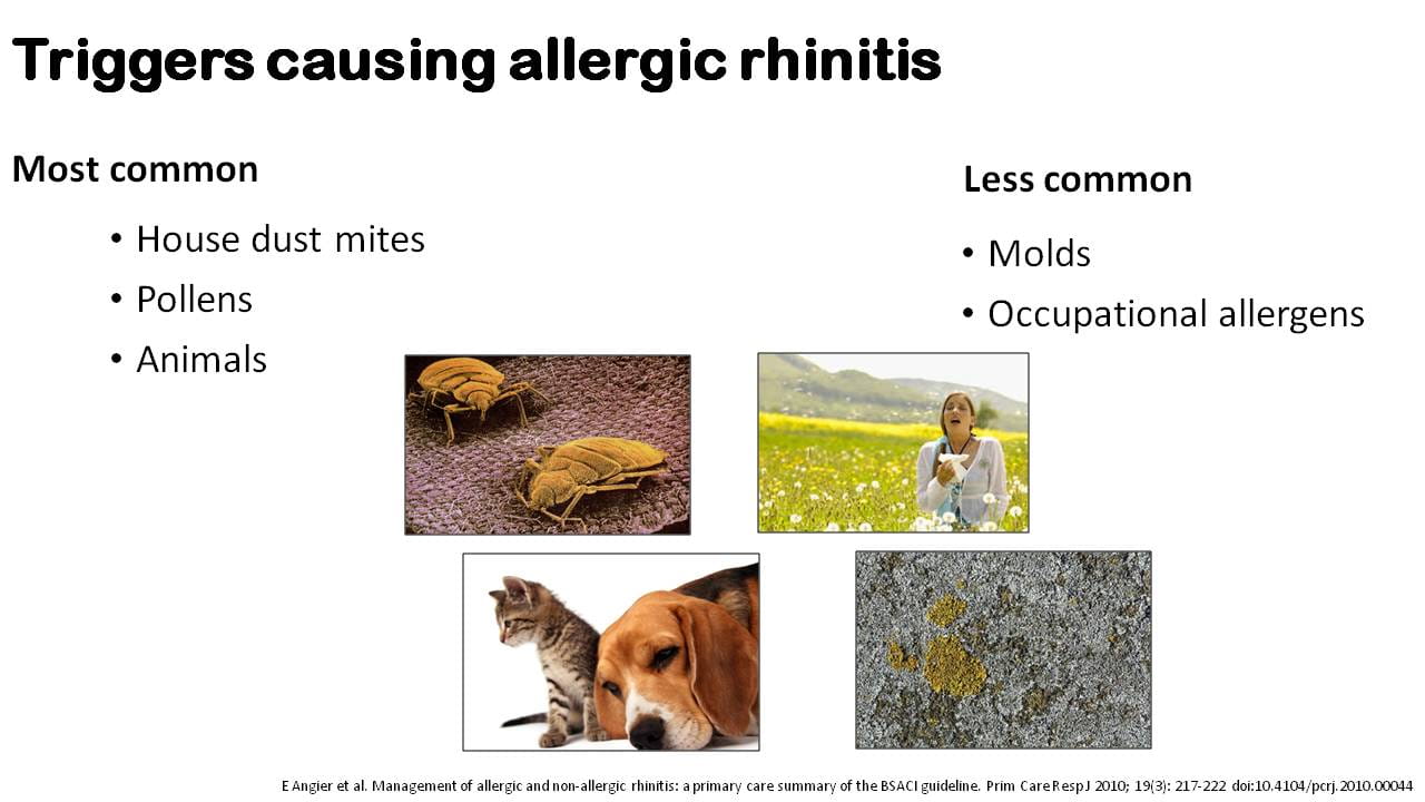 The Association Between Asthma And Allergic Rhinitis Current Perspective