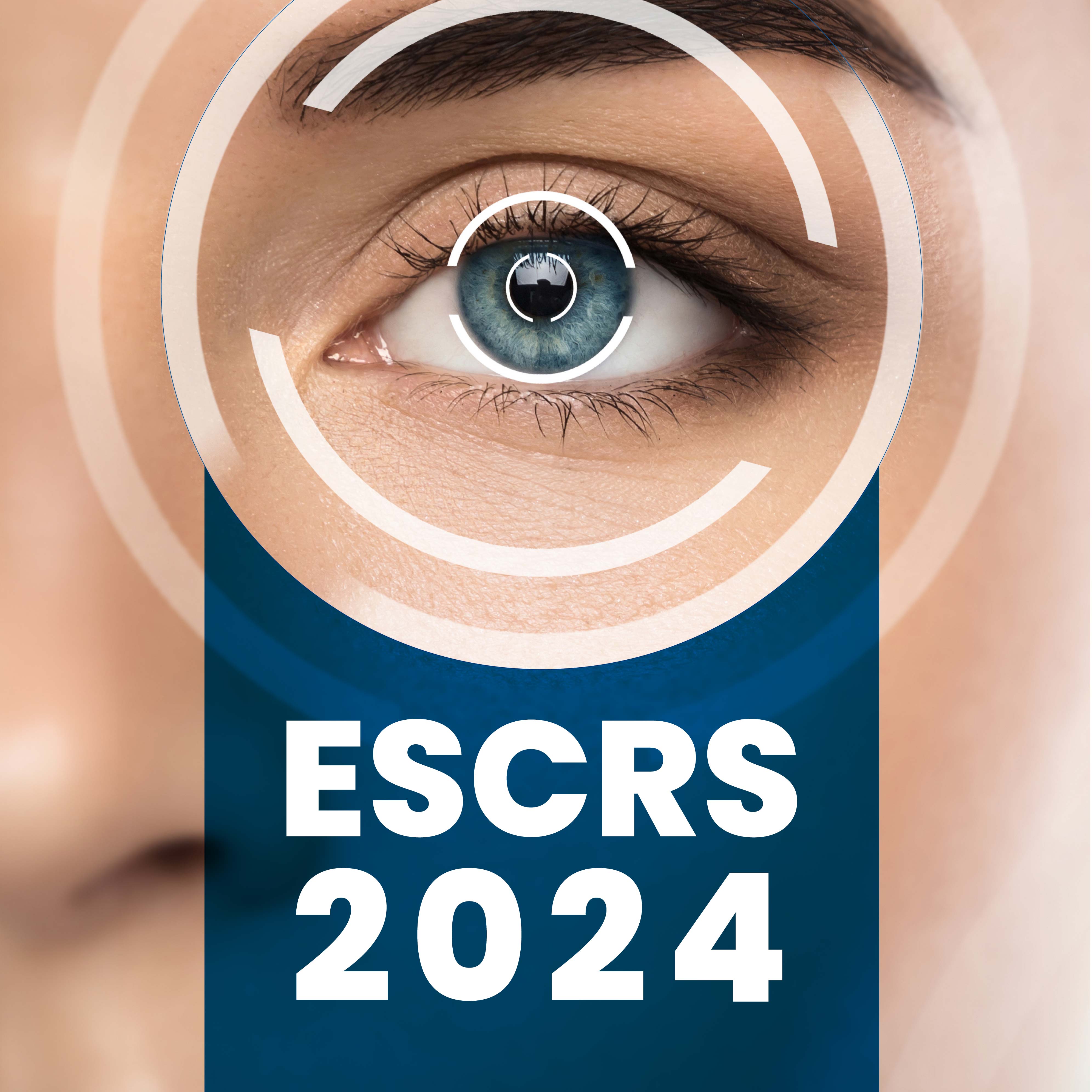 ESCRS 2024: Combination Therapy for Myopia