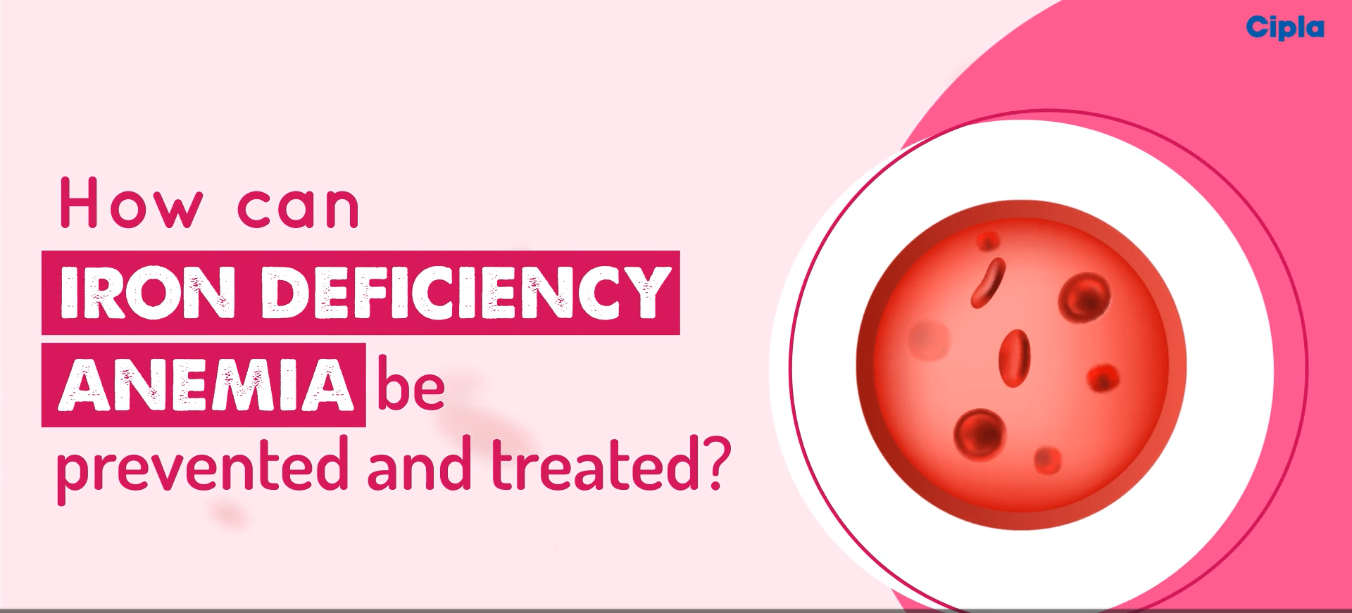 Iron Deficiency Anemia Treatment Guidelines India at Patrick Oala-rarua blog