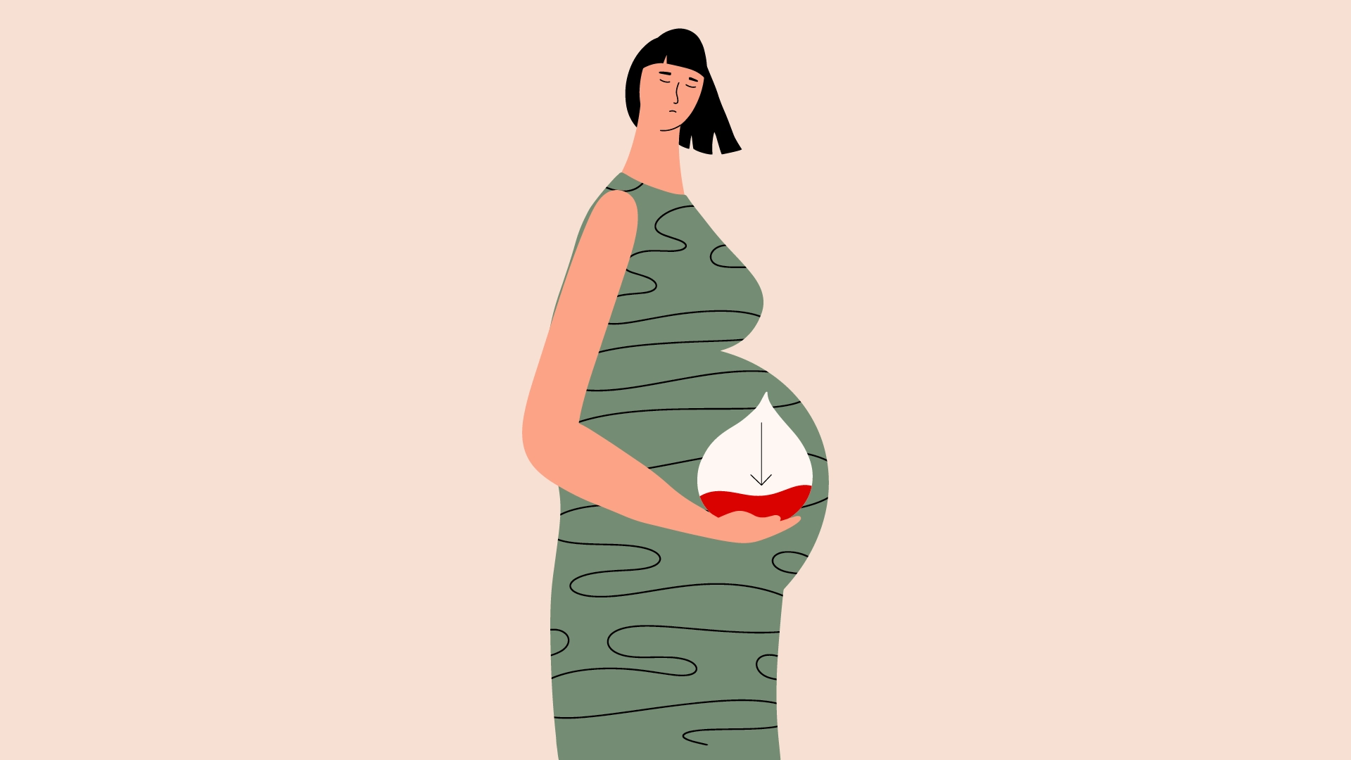 IV Ferric Carboxymaltose vs. Oral Ferrous Sulfate for Antepartum Iron ...